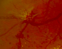 Articulo_Oftalmologia_18468