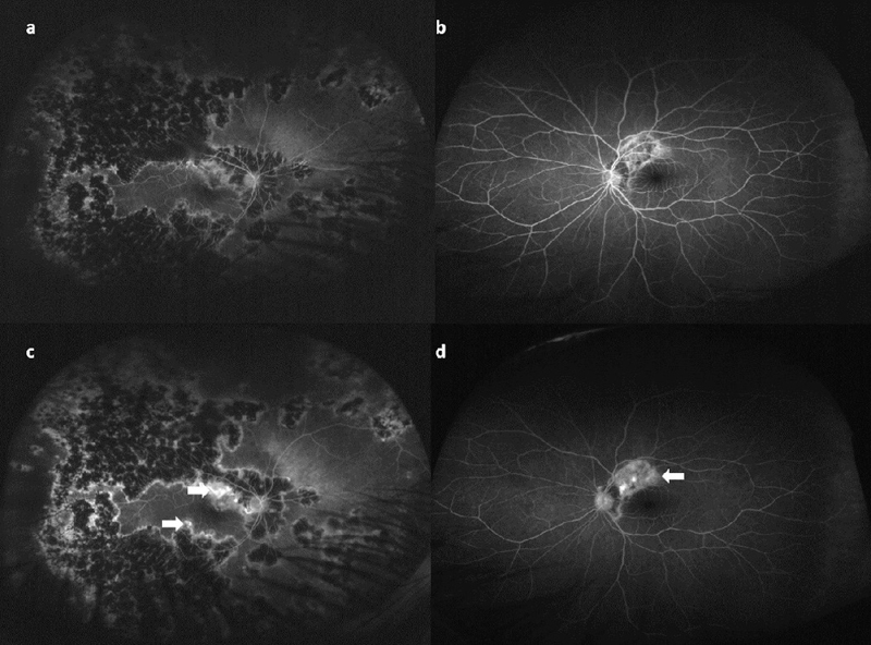 Articulo_Oftalmologia_18580